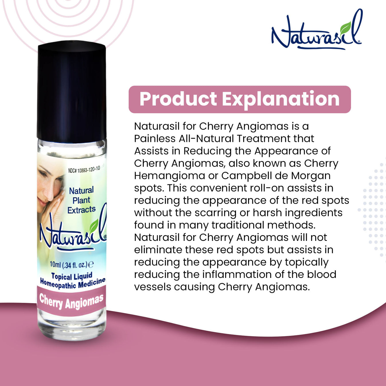Cherry Angiomas Treatment by Naturasil