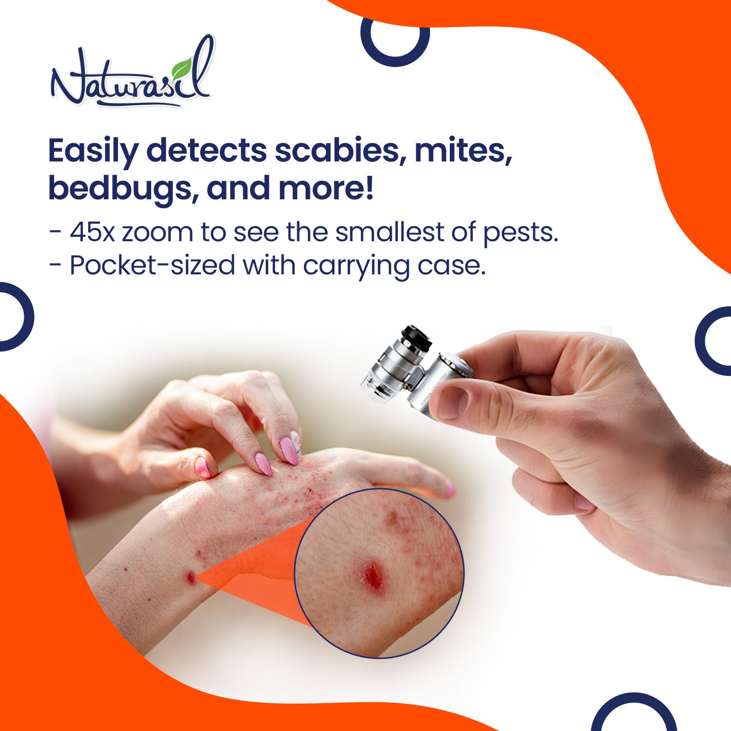 Scabies Treatment Super Pack | Treats Prolonged Or Severe Infestation ...