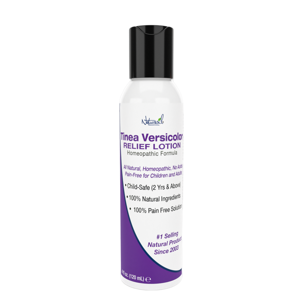 Tinea Versicolor Sulfur Medicated Lotion | 4 oz – Naturasil